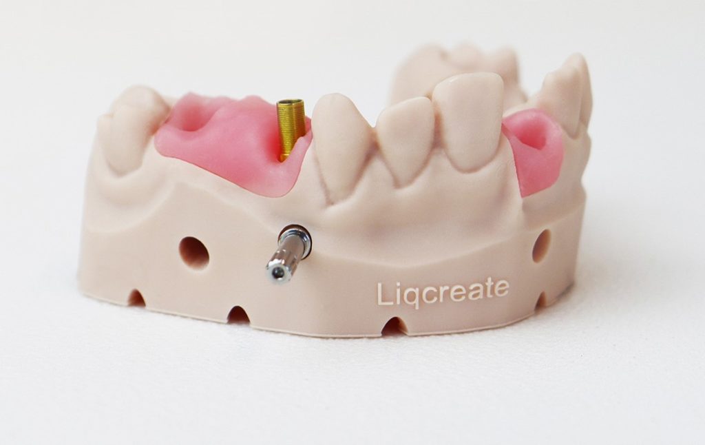 3D-printing dental gingiva mask - Soft gum-like resin