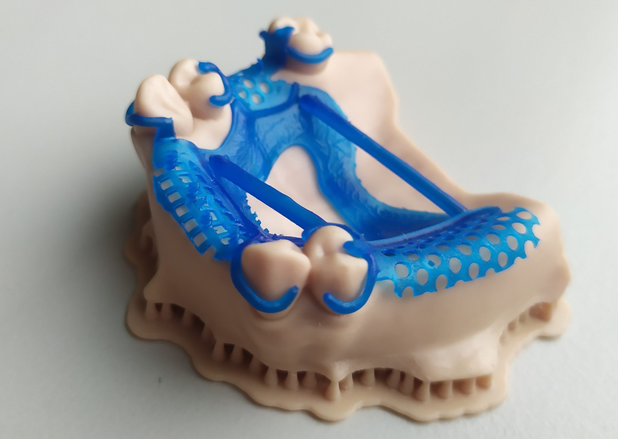 Wax Castable perfect for Jewelry & Dental casting | Liqcreate