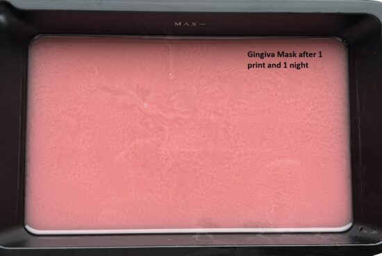 3D-printing dental gingiva mask - Soft gum-like resin
