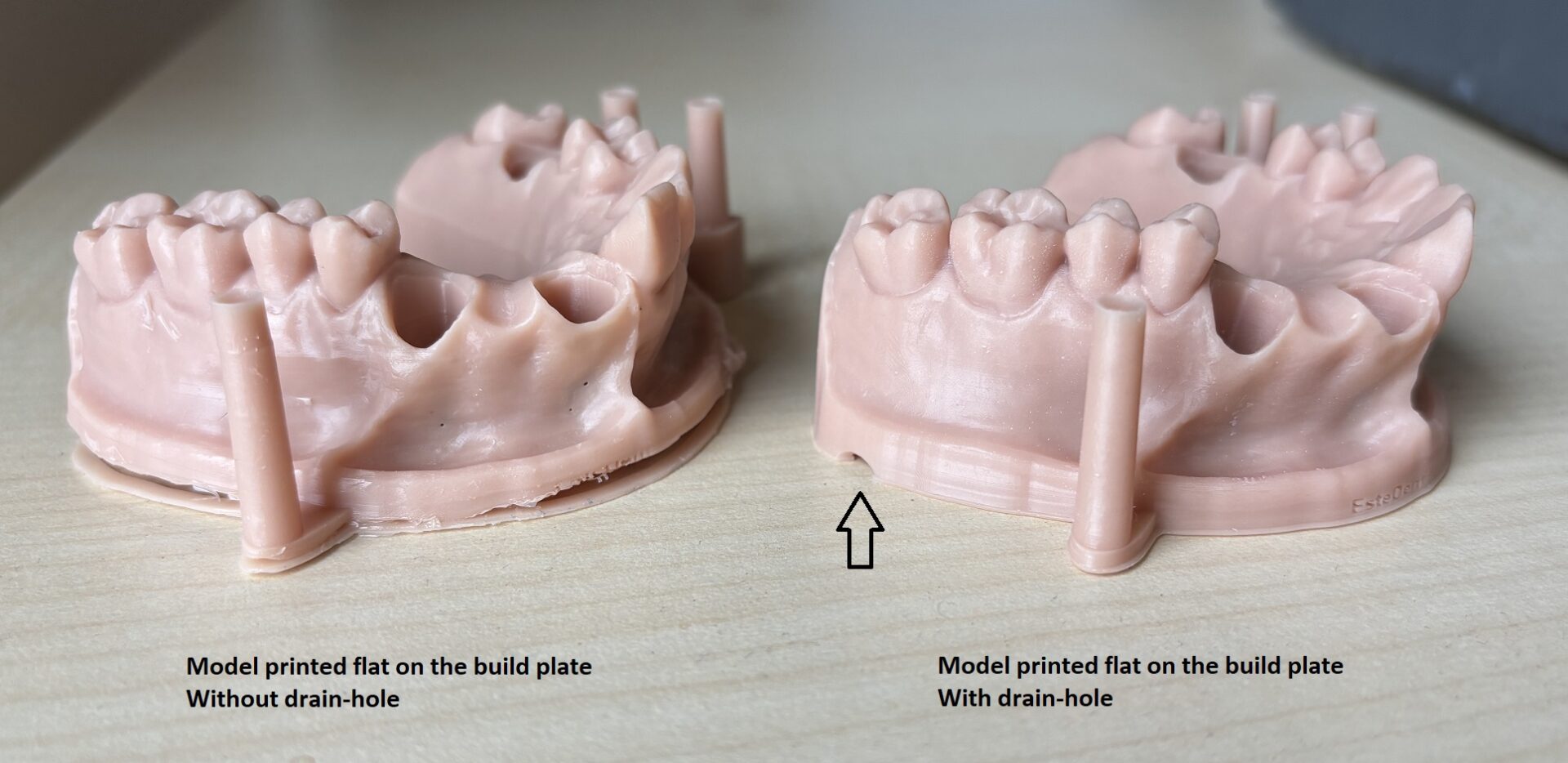 3D-printing dental models with Liqcreate Premium Model resin