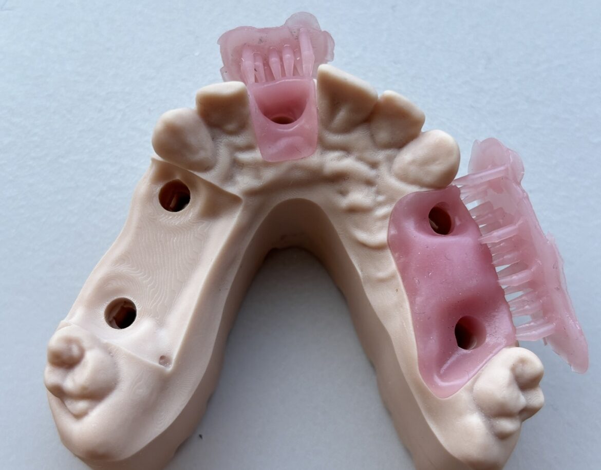 3D-printing dental gingiva mask - Soft gum-like resin