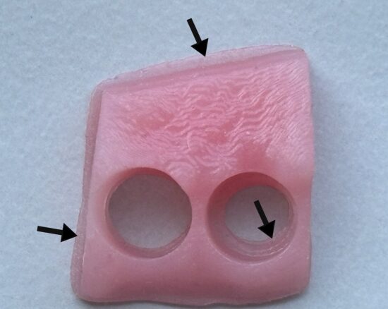 3D-printing dental gingiva mask - Soft gum-like resin