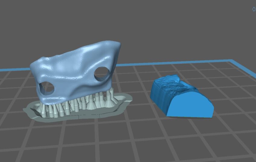3D-printing dental gingiva mask - Soft gum-like resin