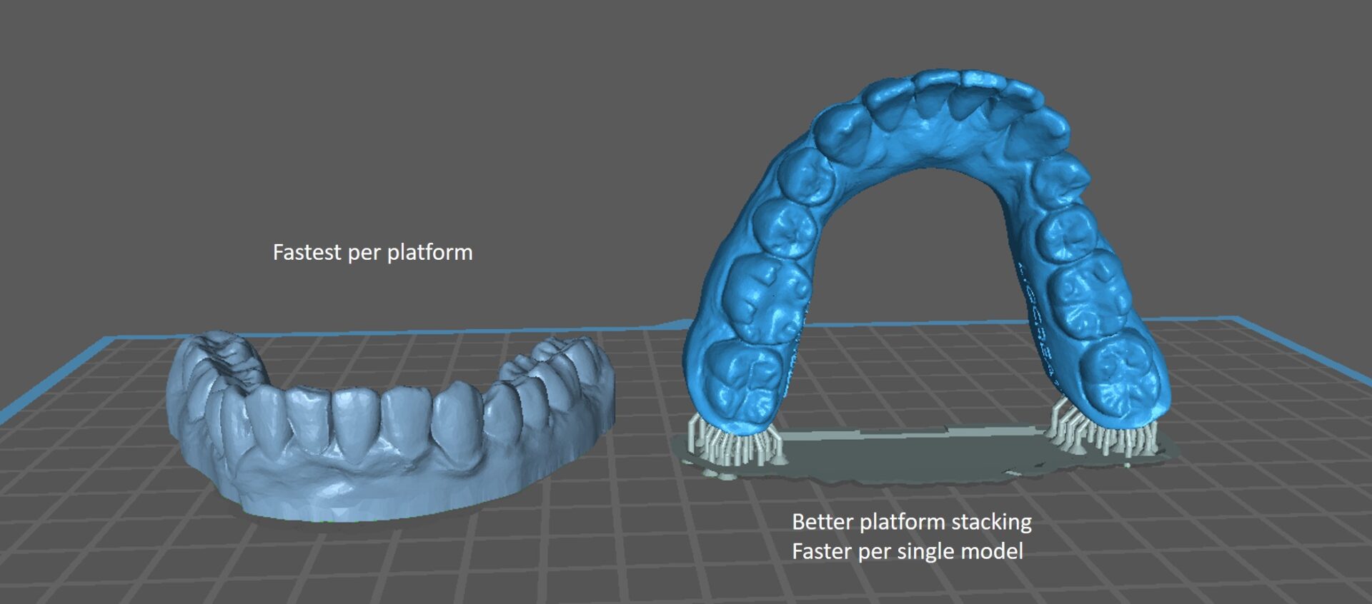 3D-printing dental models with Liqcreate Premium Model resin
